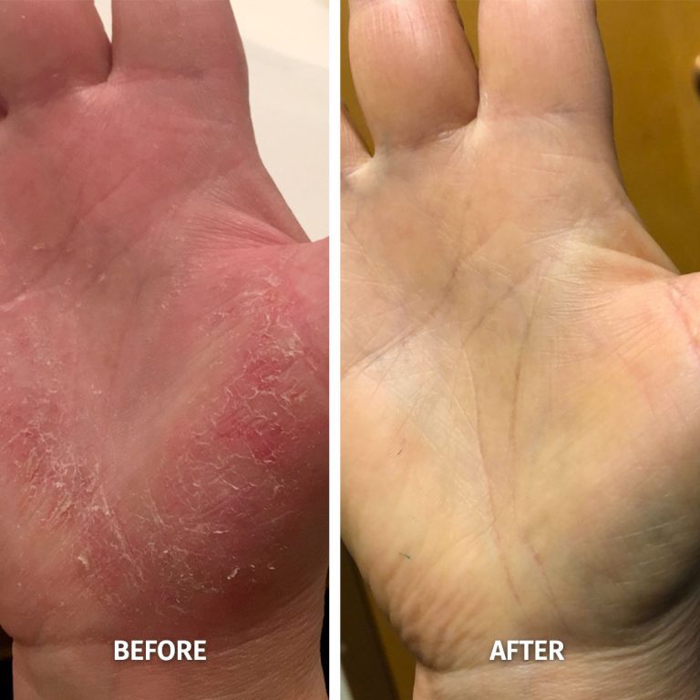 Renew Lotion - Melaleuca Renew® Intensive Skin Therapy
