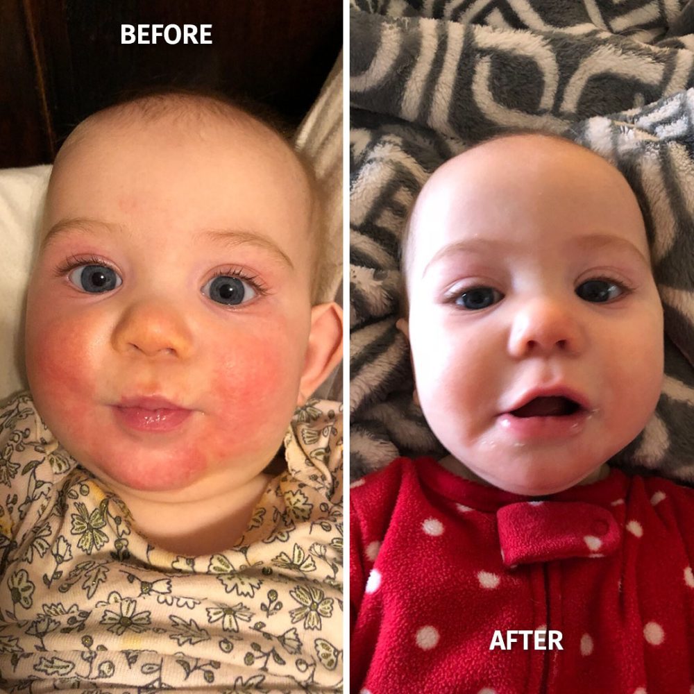 Renew Lotion - Melaleuca Renew® Intensive Skin Therapy