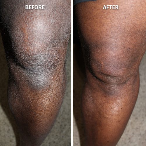 Renew Lotion - Melaleuca Renew® Intensive Skin Therapy